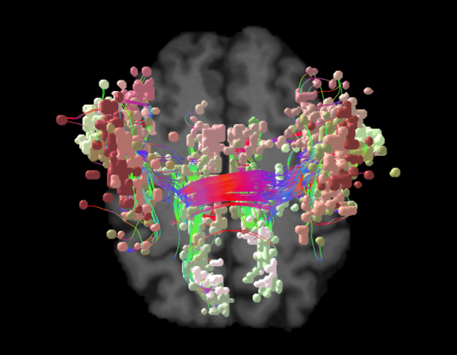 The Salience Network The Salience Network